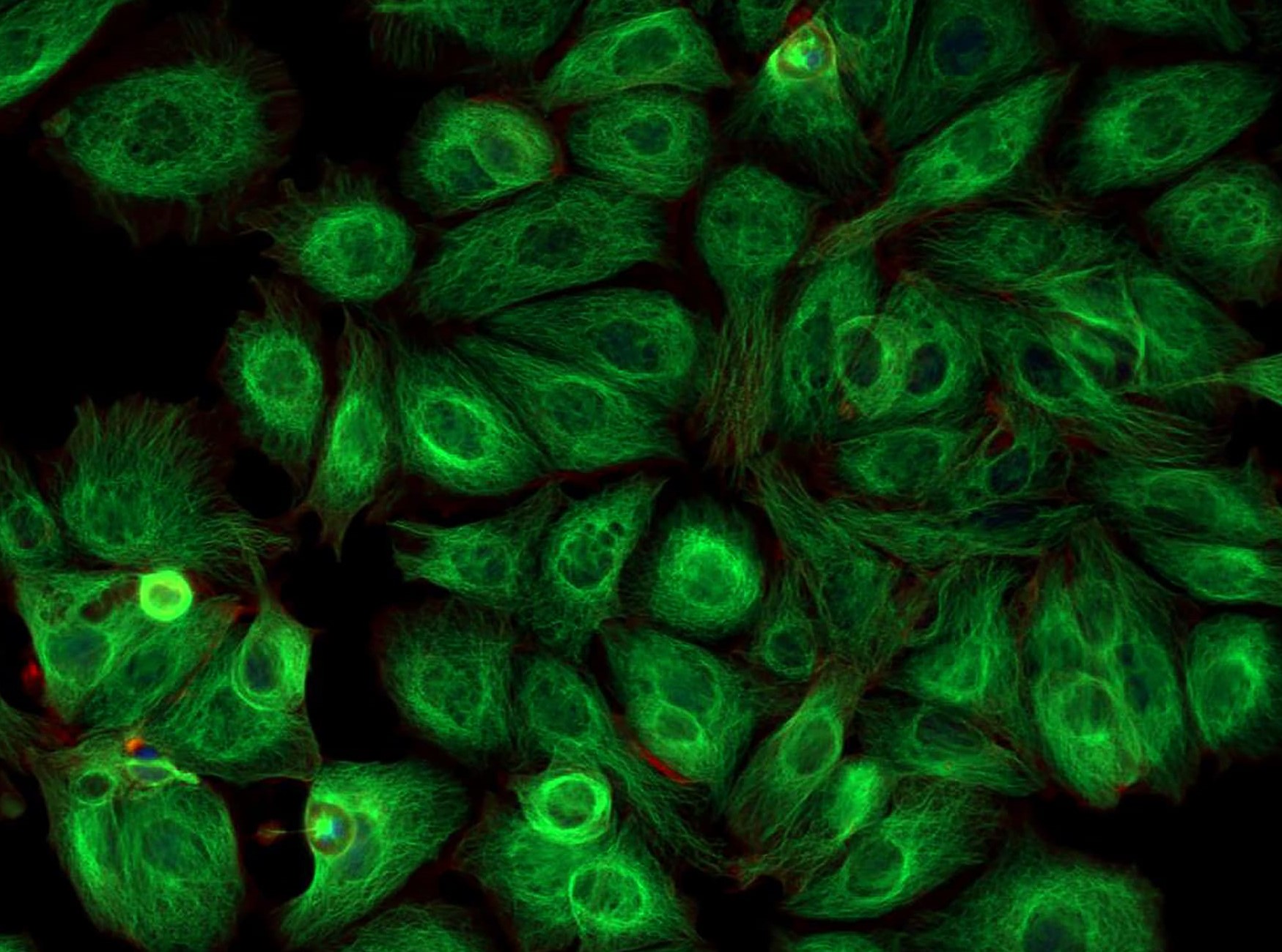 Transfection reagent - Gene Delivery - Research Area -FenicsBIO